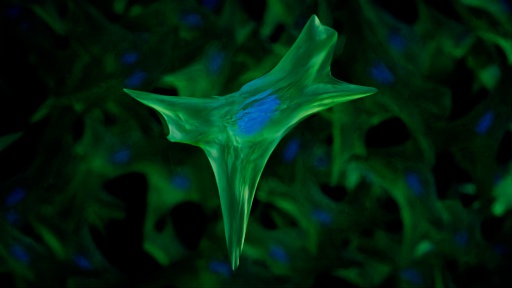 NIH scientists find treatment for rare genetic skin disorder